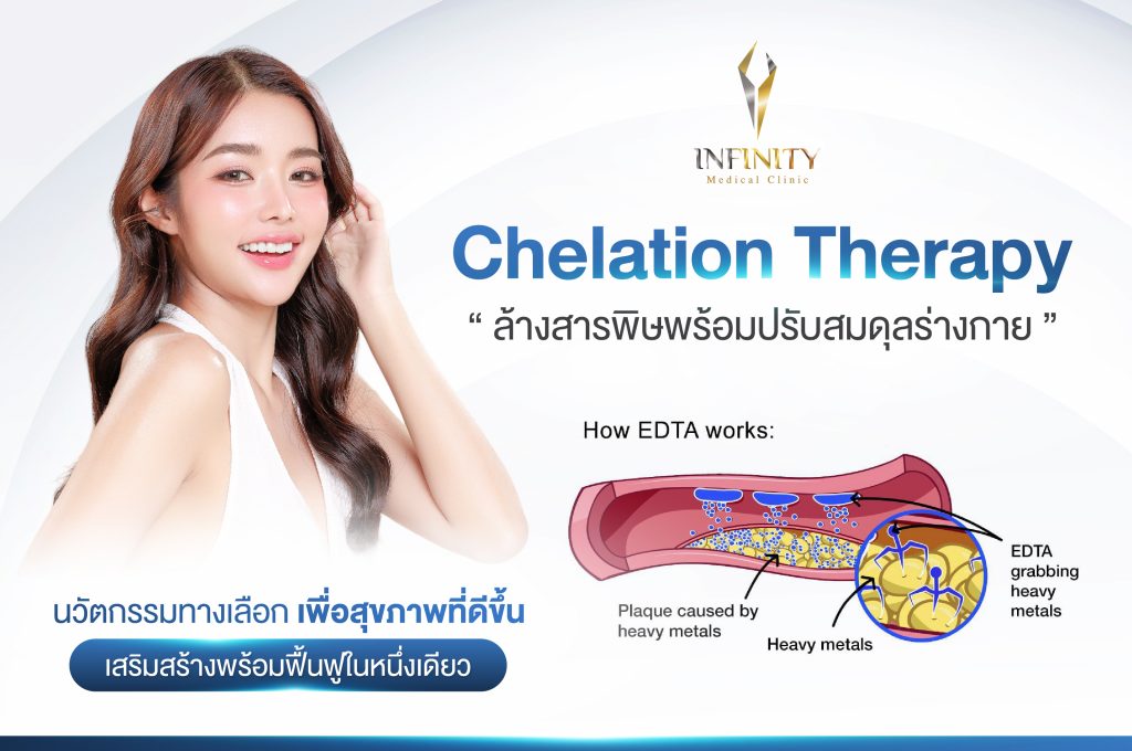 Chelation Therapy - อินฟินิตี้ เมดิคอล คลินิก